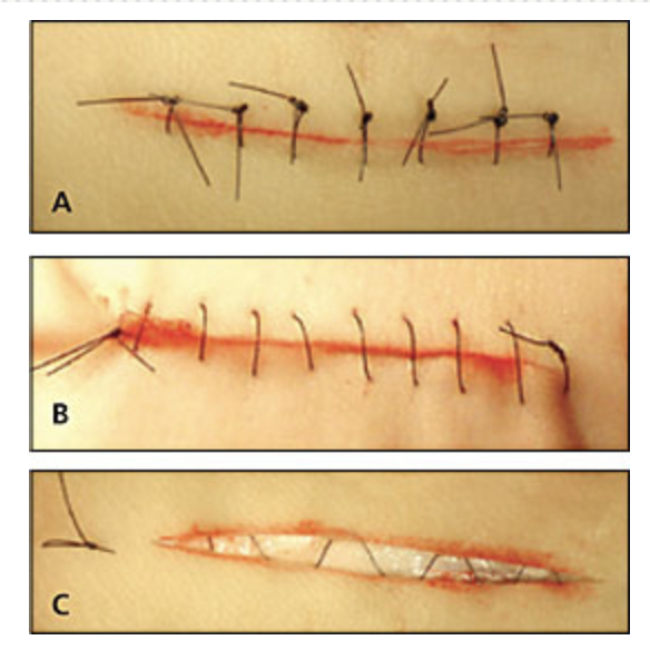 Cuts & Lacerations – Great Care At Low Costs